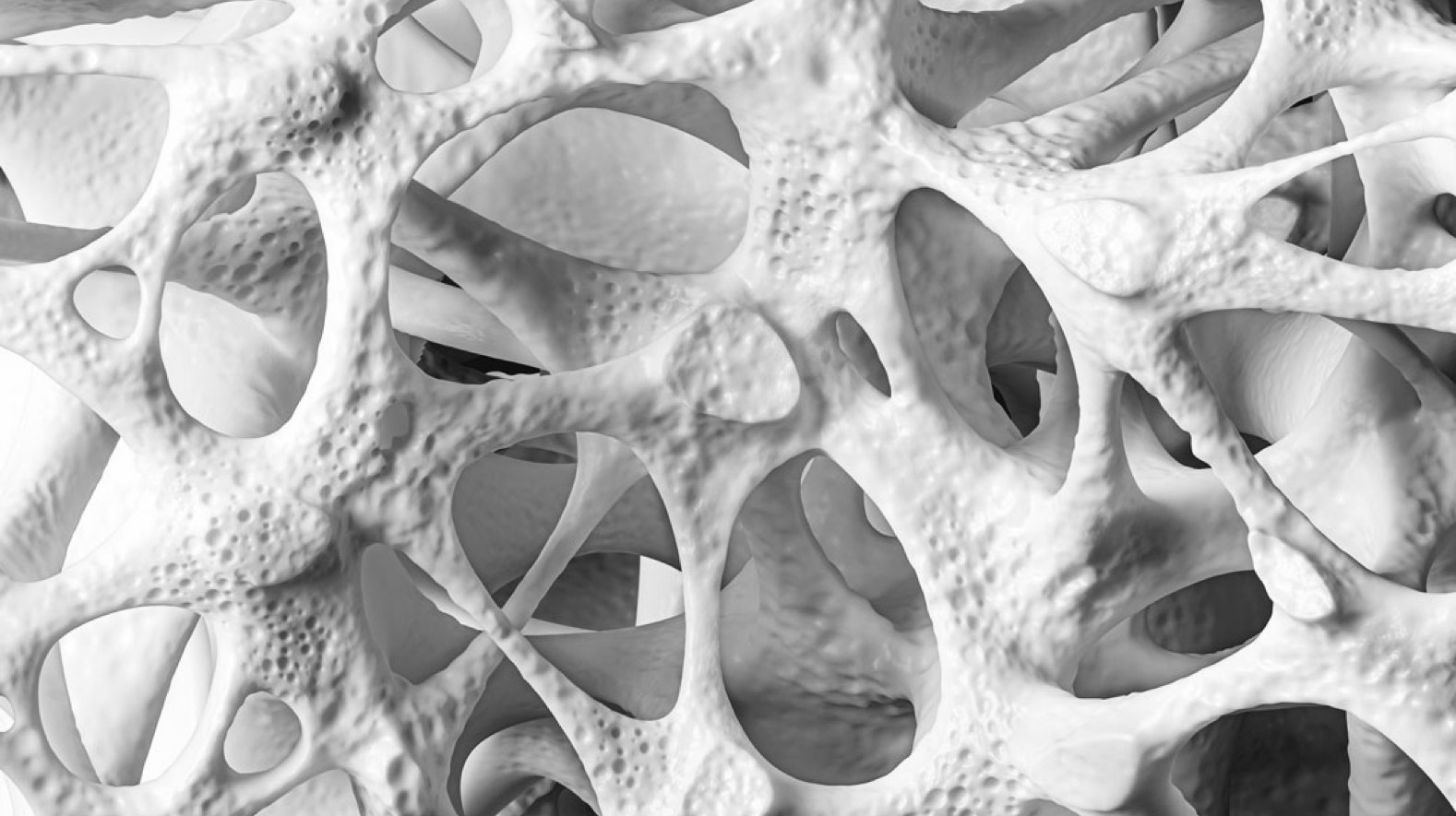PMMA Bone Cement Makevale pmma-bone-cement-makevale